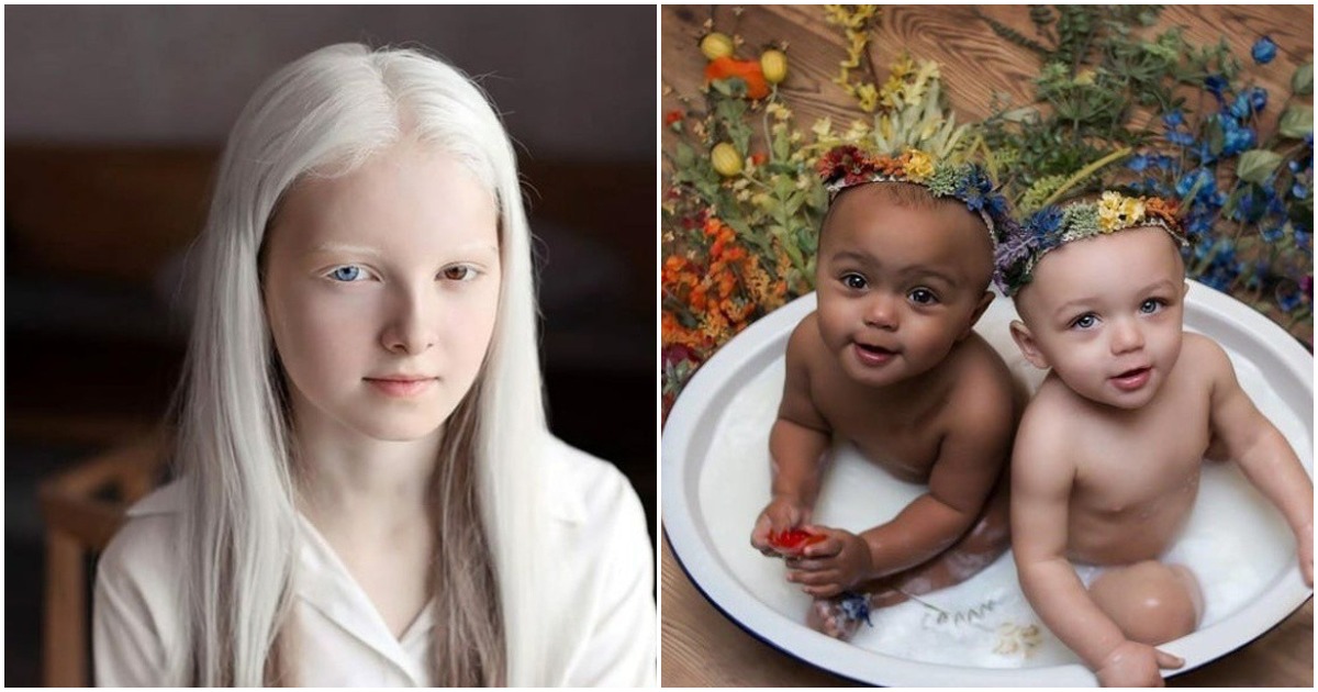 19 ember, akik valóságos genetikai rejtélynek bizonyultak – Egyhelyen